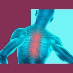 Scoliosis Compressing Lungs - Scoliosis